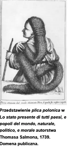 Judasz Plica Polonica (Kołtun Polski) na przestrzeni wieków ⭐ NEon24